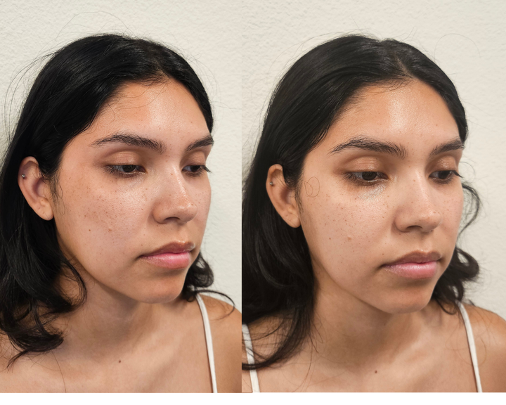 FACECO | Buccal Massage | Natural Facelift | TMJ Solution