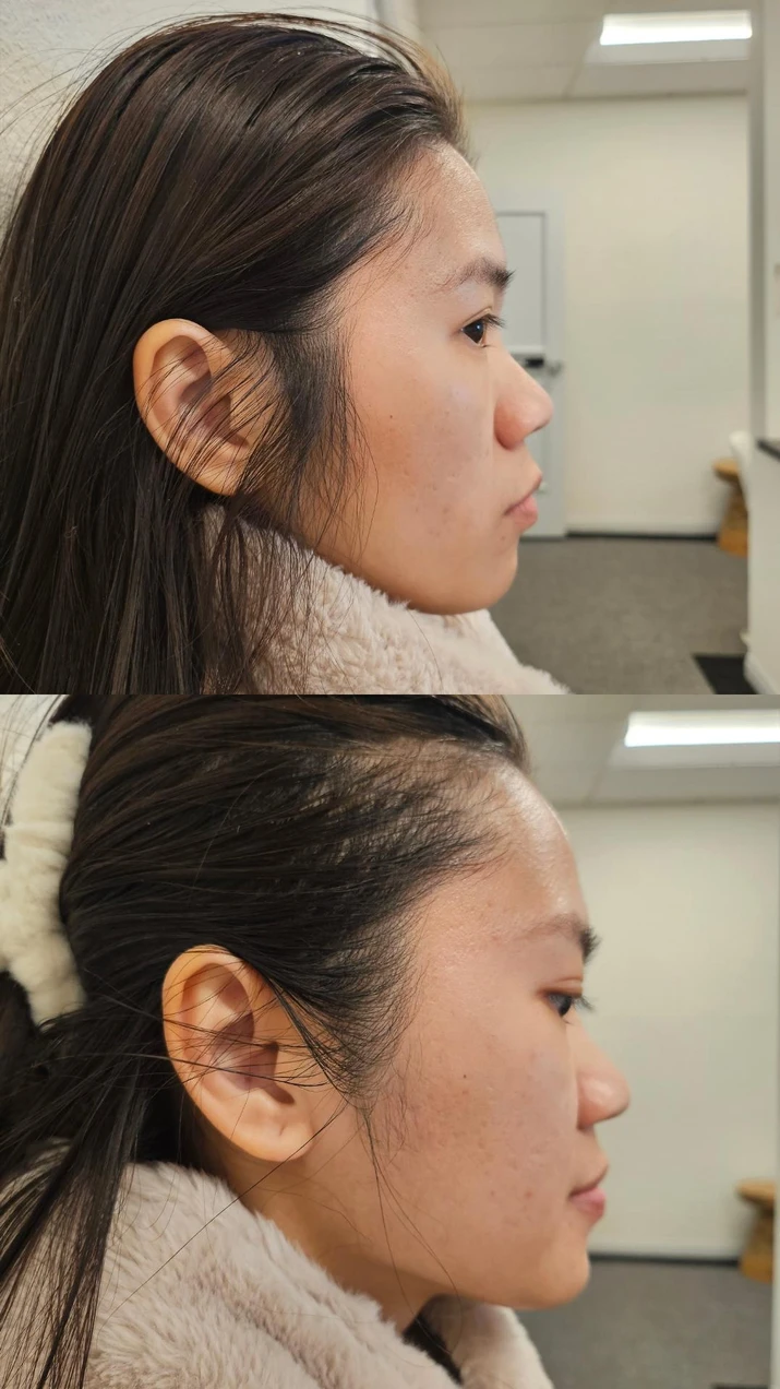 FACECO | Buccal Massage | Natural Facelift | TMJ Solution