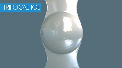 IOL Trifocali | Dott. Stefano Marchi | Oculista