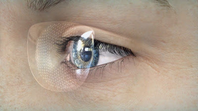 Lenti a Defocus Periferico | Dott. Stefano Marchi | Oculista