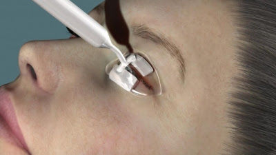 Il Trattamento MiBoFlo | Dott. Stefano Marchi | Oculista