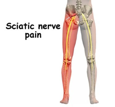 How Long Does Sciatica Leg Pain Usually Last?