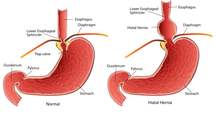 My burps taste disgusting.