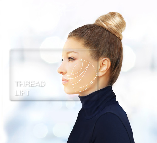 PDO Thread Lift- 2 areas | Luminex Aesthetics