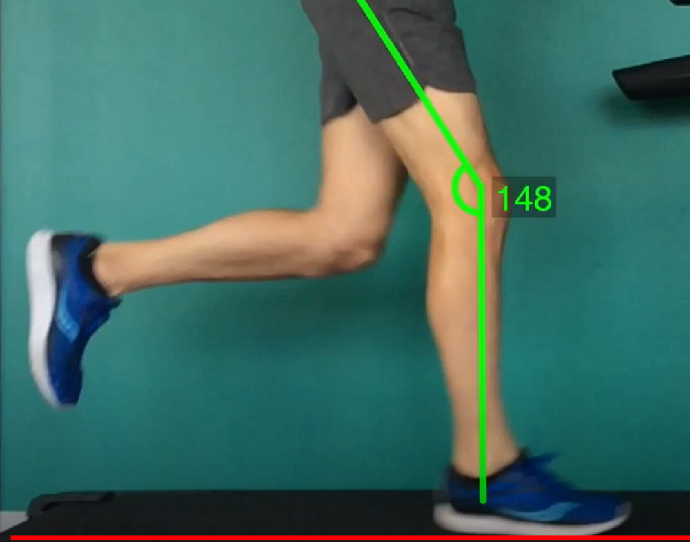 5 Tips Every Runner Should Know To Avoid Injuries