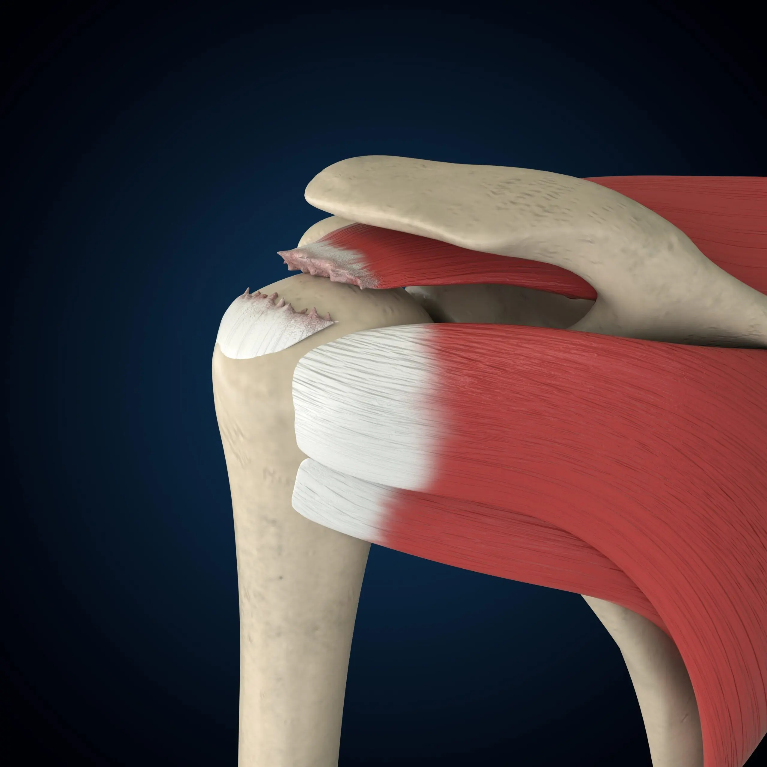 Optimize Rotator Cuff Function
