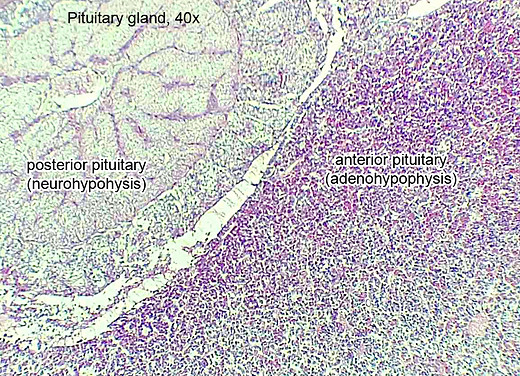 Pituitary Gland Histology Labeled Pituitary (Hypophysis) Endocrine