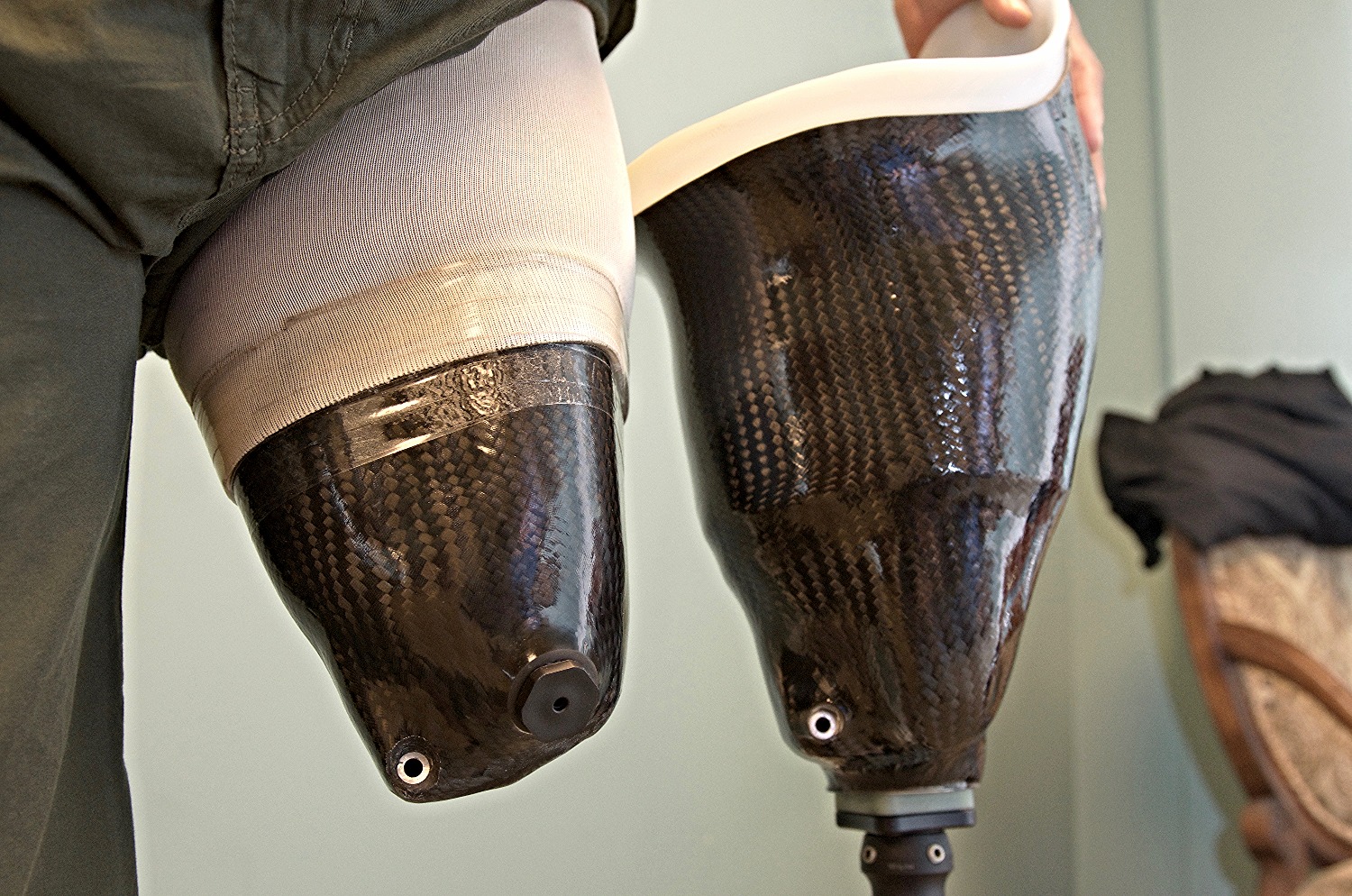 Prosthetics | bolandprosthetics