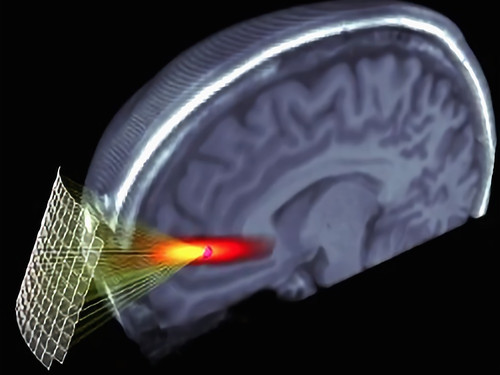 Open-LIFU 2.0 - Order Reservation | OPENWATER