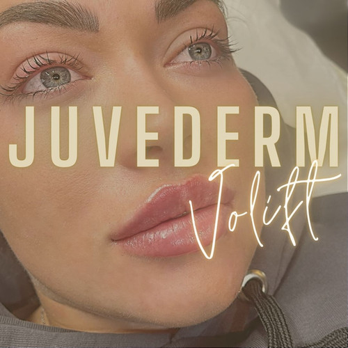 1ML JUVEDERM VOLIFT - LIPS | Dani Louise Sidcup