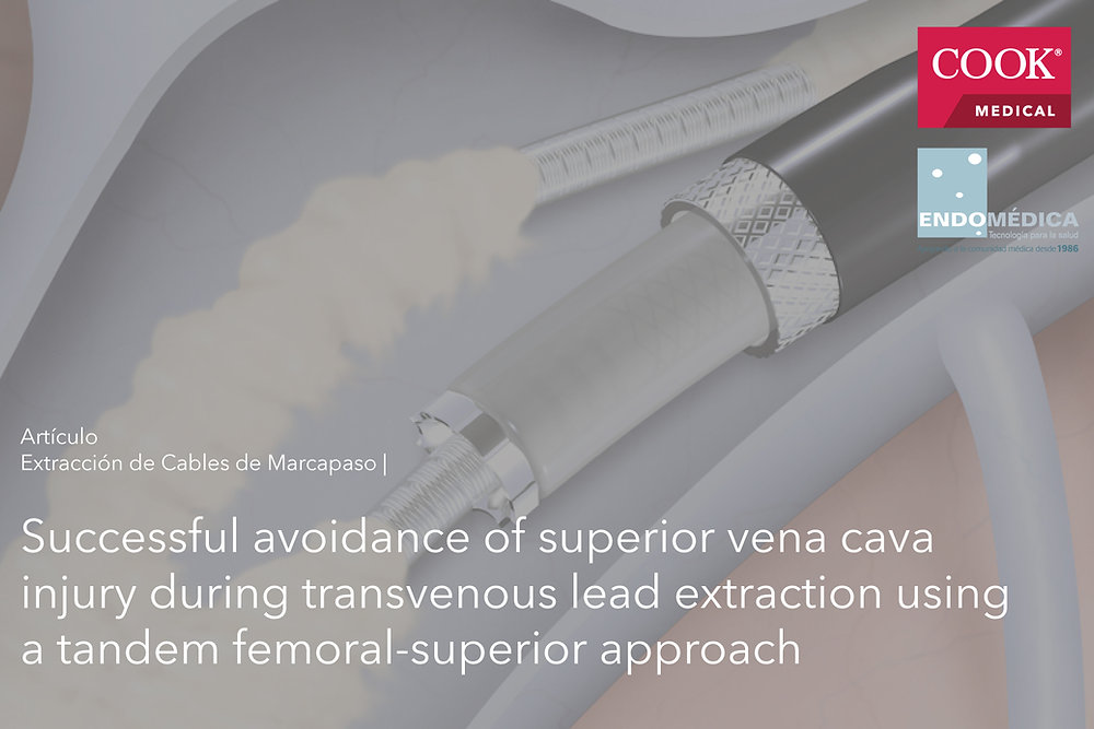 [Estudio] Successful avoidance of superior vena cava injuryduring ...