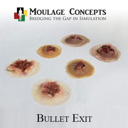 Bullet Exit Wound | mc-new-platform