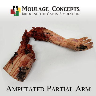 Amputated Partial Arm | mc-new-platform
