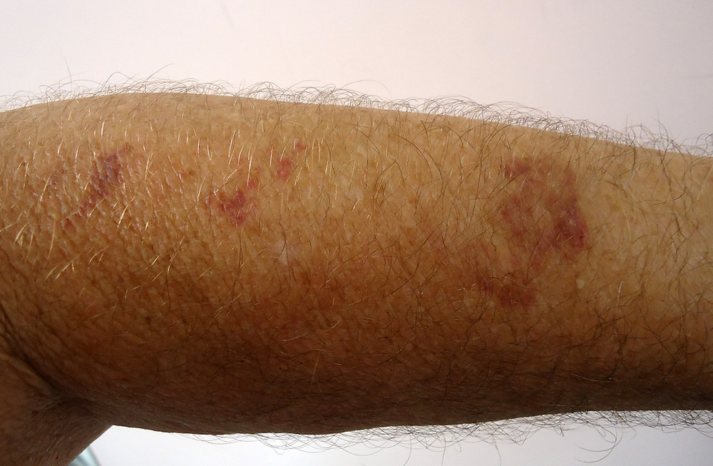 What Happens To Your Skin As You Age what-happens-to-your-skin-as-you-age