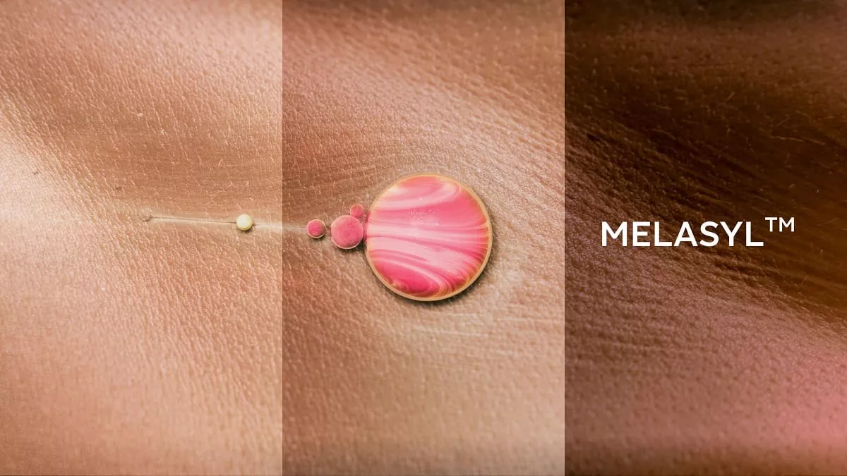 L'Oréal Introduces Melasyl: A Breakthrough Solution for Skin Pigmentation