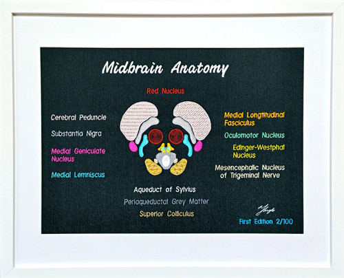 Midbrain Anatomy | AllegationBrighton