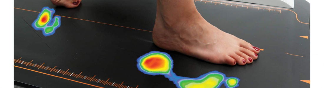 Pressure plate Gait analysis | Kent Sport Podiatry | United Kingdom