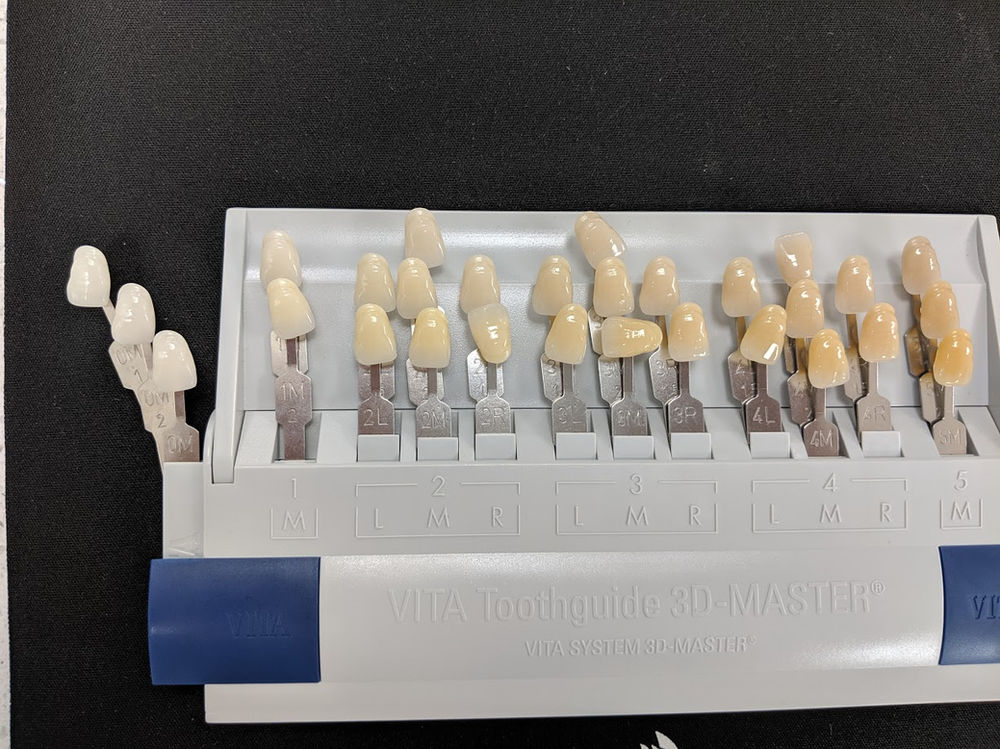 Brush Every Day But Teeth Are Still Yellow: The Truth