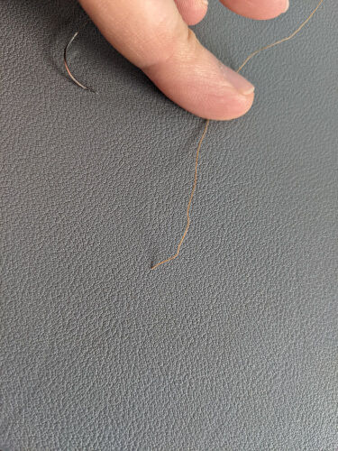 What Do Dissolvable Stitches Look Like: Images & Videos - 1311 Jackson ...