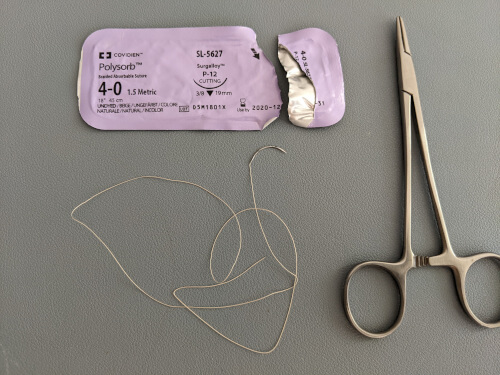 How To Identify Dissolvable Stitches By Color - 1311 Jackson Ave Dental ...