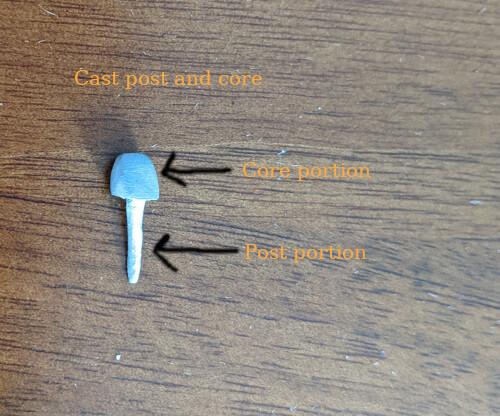 Root Canal Tooth Broke Off At Gum Line: Treatment Options - 1311 ...