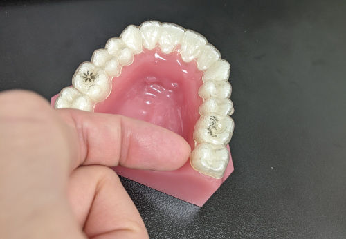 How To Remove Invisalign Trays - 1311 Jackson Ave Dental | Dentist in ...