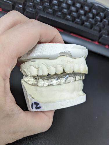 How Do I Know If My Night Guard Fits Properly? - 1311 Jackson Ave ...