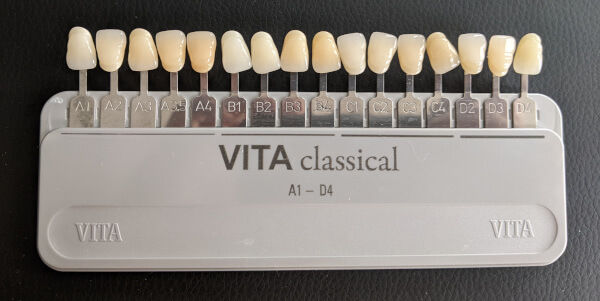 What Is The Average Tooth Color? - 1311 Jackson Ave Dental | Dentist in ...