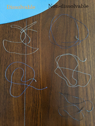 Dissolvable Stitches: Things To Know - 1311 Jackson Ave Dental ...