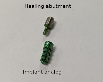 Dental Implant Healing Cap Fell Out, What To Do? - 1311 Jackson Ave ...