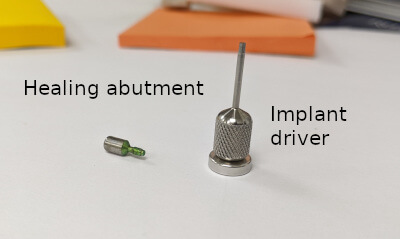 Dental Implant Healing Cap Fell Out, What To Do? - 1311 Jackson Ave ...