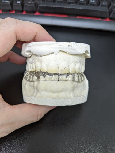 How Do I Know If My Night Guard Fits Properly? - 1311 Jackson Ave ...