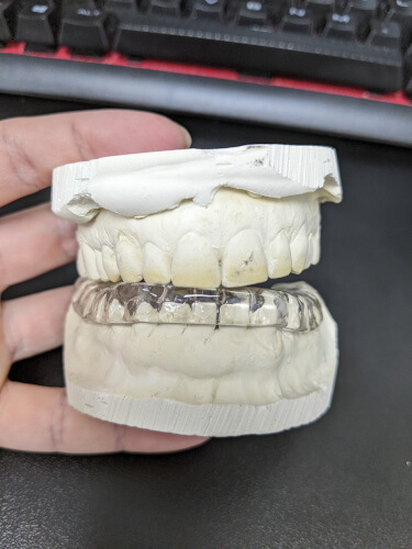 How Do I Know If My Night Guard Fits Properly? - 1311 Jackson Ave ...