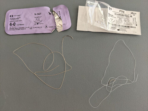 Do Stitches Change Color As They Dissolve? - 1311 Jackson Ave Dental ...