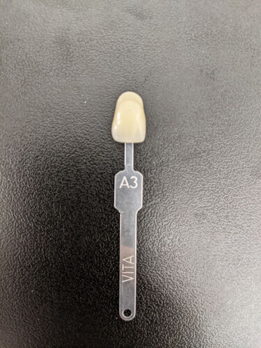What Is The Average Tooth Color 1311 Jackson Ave Dental Dentist In What Is The Average Tooth Color 1311 Jackson Ave Dental Dentist In