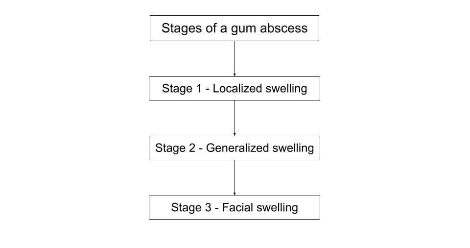 Each Stage of a Gum Abscess - 1311 Jackson Ave Dental | Dentist in Long ...