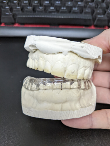 How Do I Know If My Night Guard Fits Properly? - 1311 Jackson Ave ...