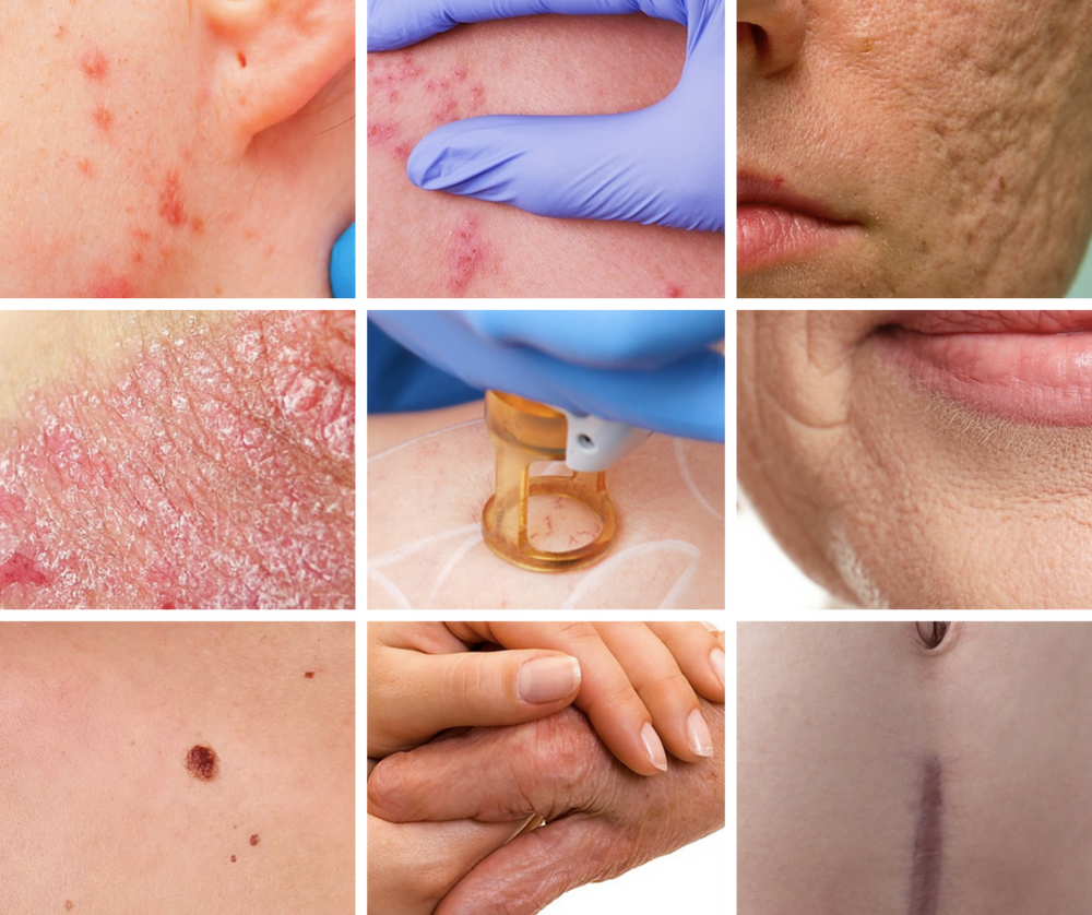 Inside the Dermal Clinicians Toolbox, Part 2