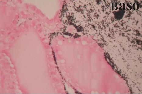 Calcium Salt Stain (Silver nitrate method)