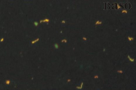 TB Auramine O (Fluorescence) Stain | indolabarthamedika