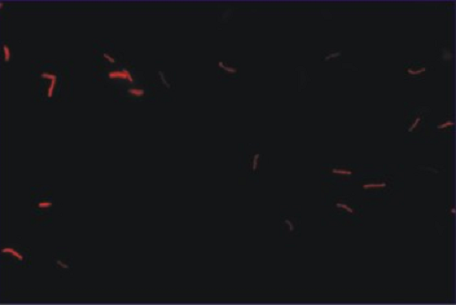 TB Stain(Auramine O-Rhodamine staining method) | indolabarthamedika