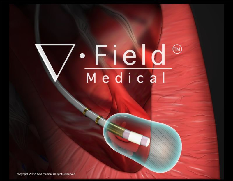 Farapulse founder’s Field Medical partners with CardioNXT on novel ...