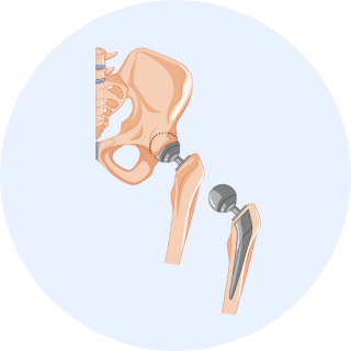 The Joint Replacement Center