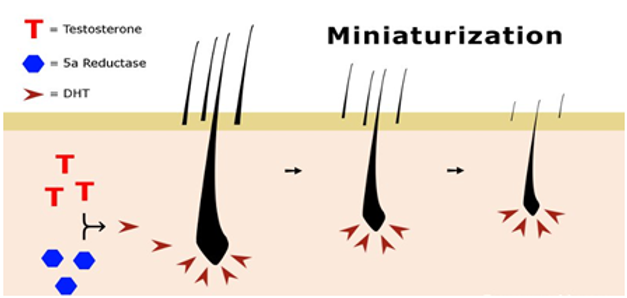 Wat is Dihydrotestosteron (DHT)? DHT en haaruitval uitgelegd