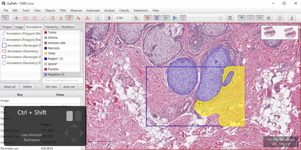 Using Software For Research Digital Pathology Through Qupath The Unity