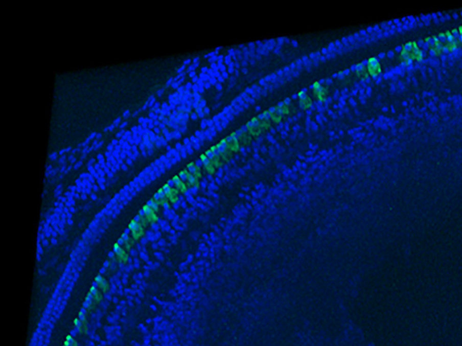 Atelier : Avancées en imagerie optique pour les neurosciences 21-22