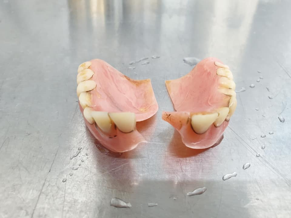 Denture Repairs While You Wait | Allied Denture Clinic