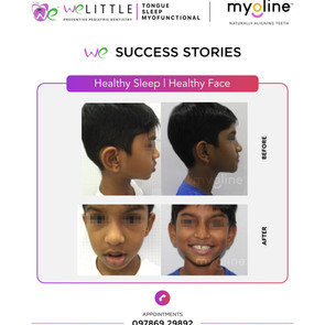 Before/after Gallery | Myoline