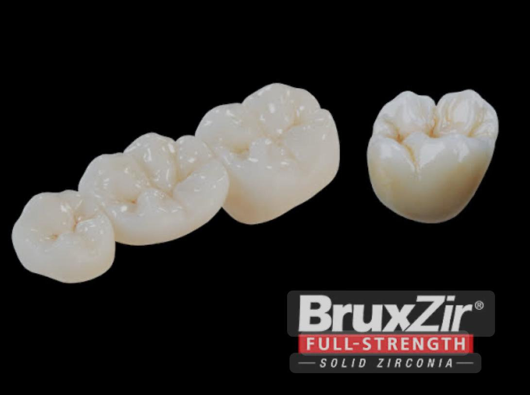 Bruxir solid zirconia unbreakable