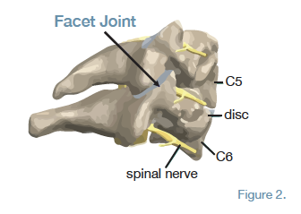 Why Does My Neck Hurt? Why Is My Neck Stiff?